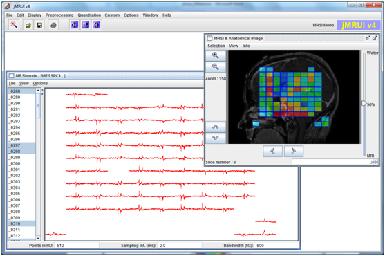 CREATIS NMR - MRS ANS MRSI DATA PROCESSING SOFTWARE - Tana Corporation